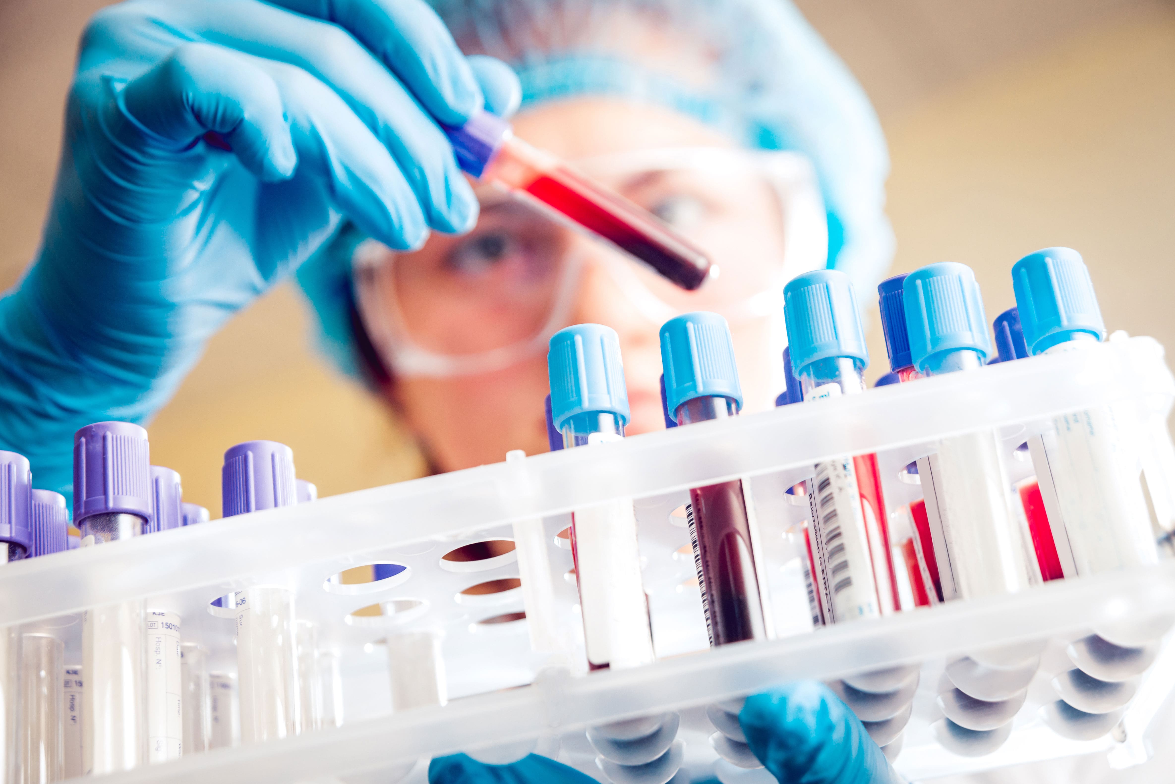 Biosafety Cabinet Installation and Maintenance Best Practices | Esco ...